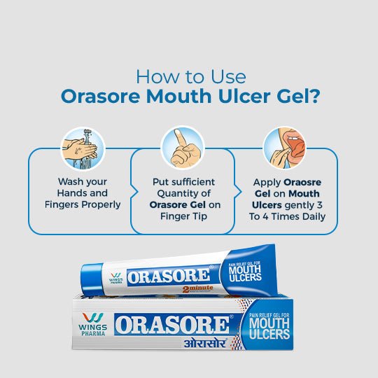 Orasore Mouth Ulcer Gel | Relief from Painful Mouth Ulcers – Health ...
