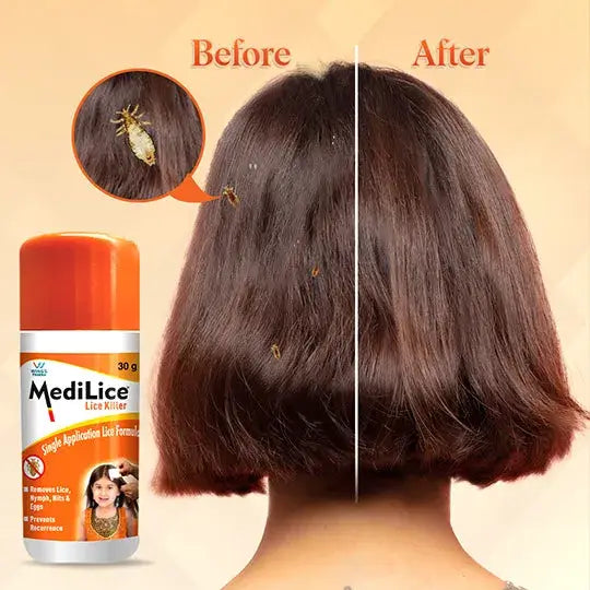 Medilice Lice & Scabies Combo | Anti Lice Lotion 30ml + Medicated Soap ...
